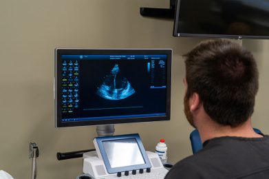 Cardiac Sonography Program | Kirtland Community College